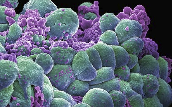 Los hongos en nuestro cuerpo - sincroscan